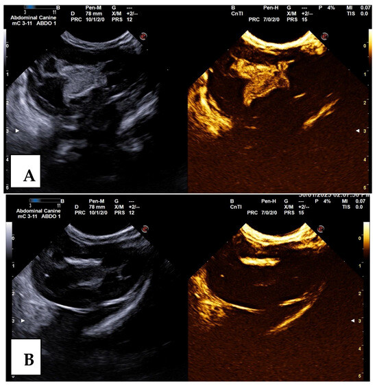 A Comparison of Contrast-Enhanced Voiding Urosonography (CE-VUS) and ...
