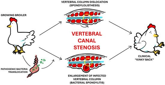 Genetic and Environmental Factors Contributing to the Pathogenesis of ...