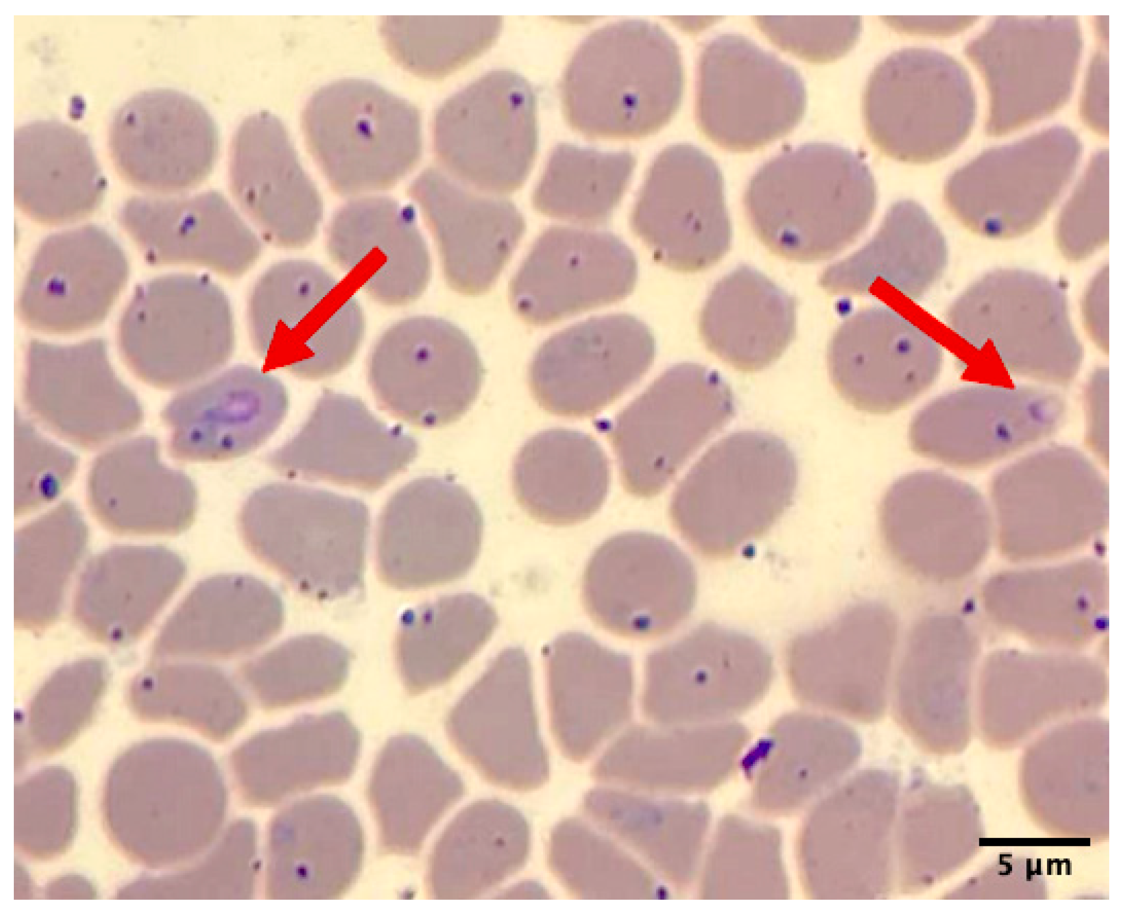 Clinical Theileriosis in an Endangered Malayan Tapir Diagnosed Using a ...