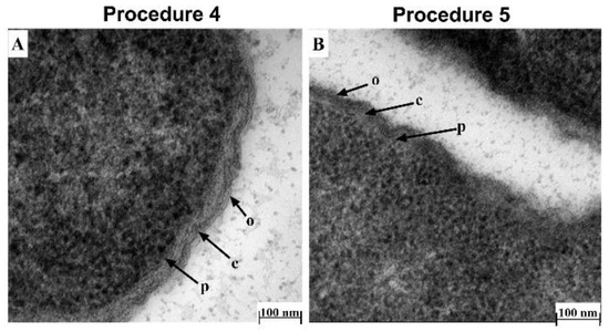 Cell Membrane Electron Micrograph