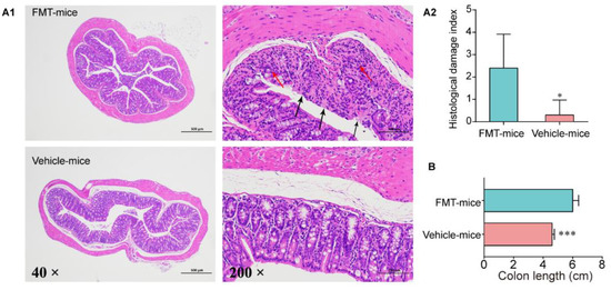 Core Altered Microorganisms in Colitis Mouse Model: A Comprehensive ...