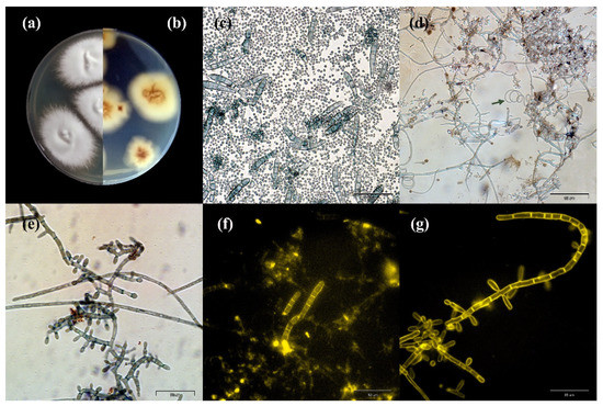 Laboratory Diagnosis and In Vitro Antifungal Susceptibility of ...