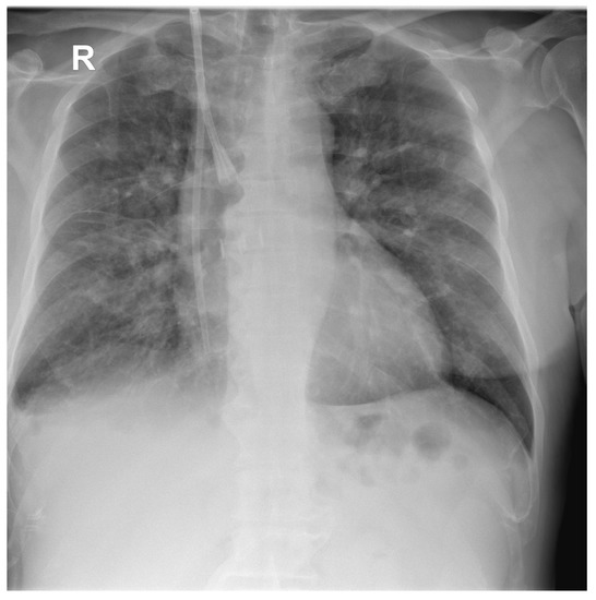 Syndromic Testing in Infectious Diseases: From Diagnostic Stewardship ...
