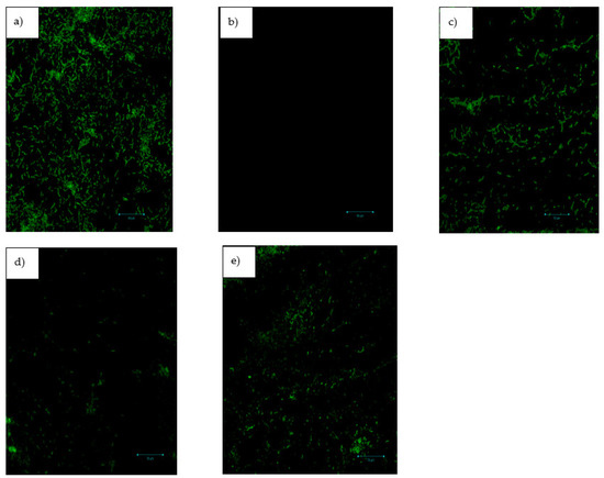 Cheminformatics Bioprospection of Sunflower Seeds’ Oils against Quorum ...
