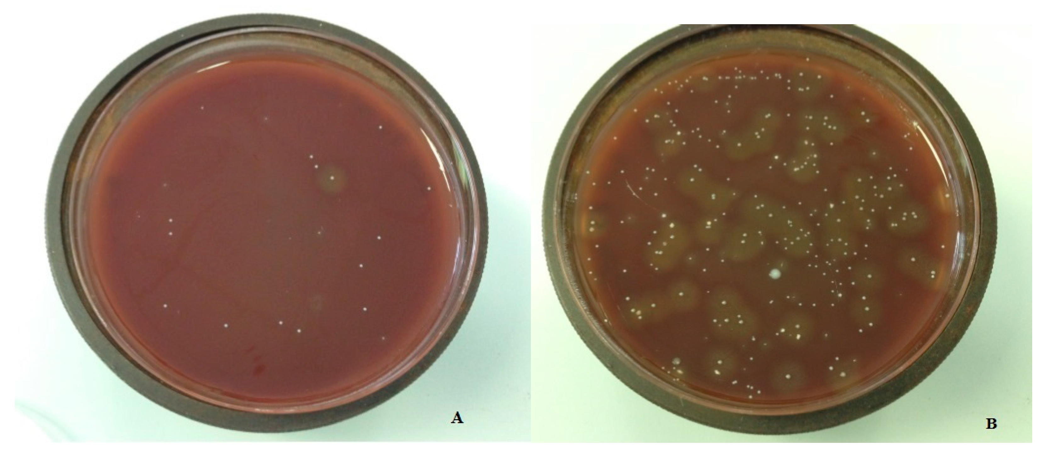 Microbiological Retention on PTFE versus Silk Suture: A Quantitative ...