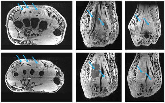 Mycobacterium marinum: A Challenging Cause of Protracted Tenosynovitis