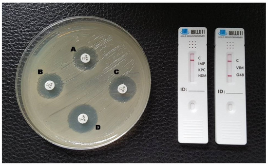 Replacement of the Double Meropenem Disc Test with a Lateral Flow Assay ...