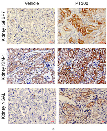 Mechanisms of Piperacillin/Tazobactam Nephrotoxicity: Piperacillin ...