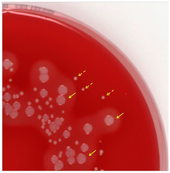 Detection, Identification and Diagnostic Characterization of the ...
