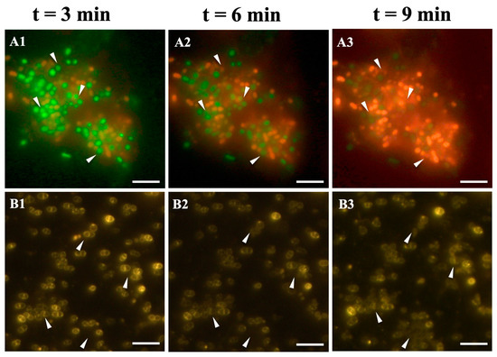 Characterization of Two Novel Endolysins from Bacteriophage PEF1 and Evaluation of Their ...