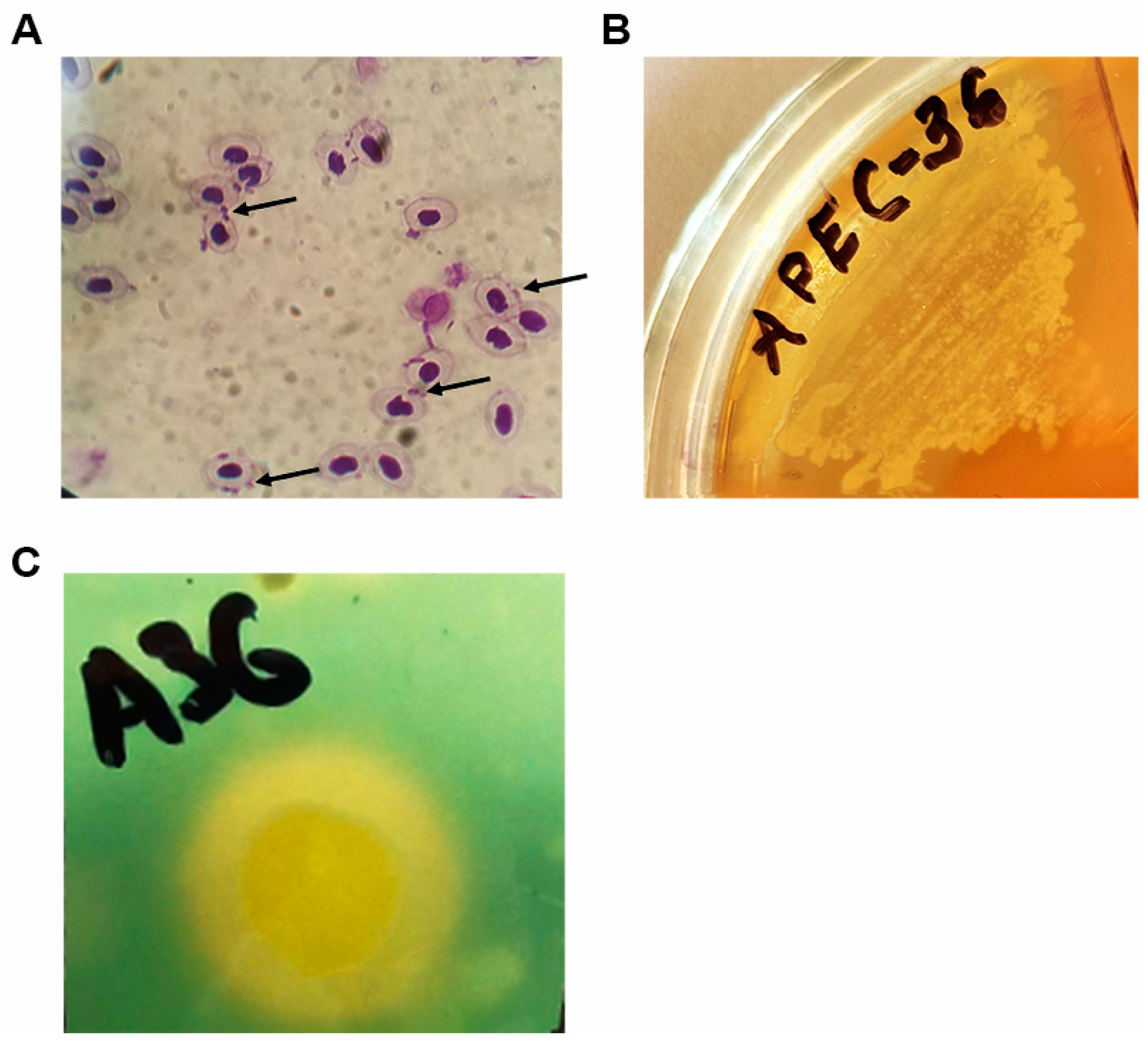 Determinants Of Antibiotic Resistance And Virulence Factors In The Genome Of Escherichia Coli