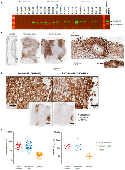 Characterization of Active MMP9 in Chronic Inflammatory Diseases Using ...