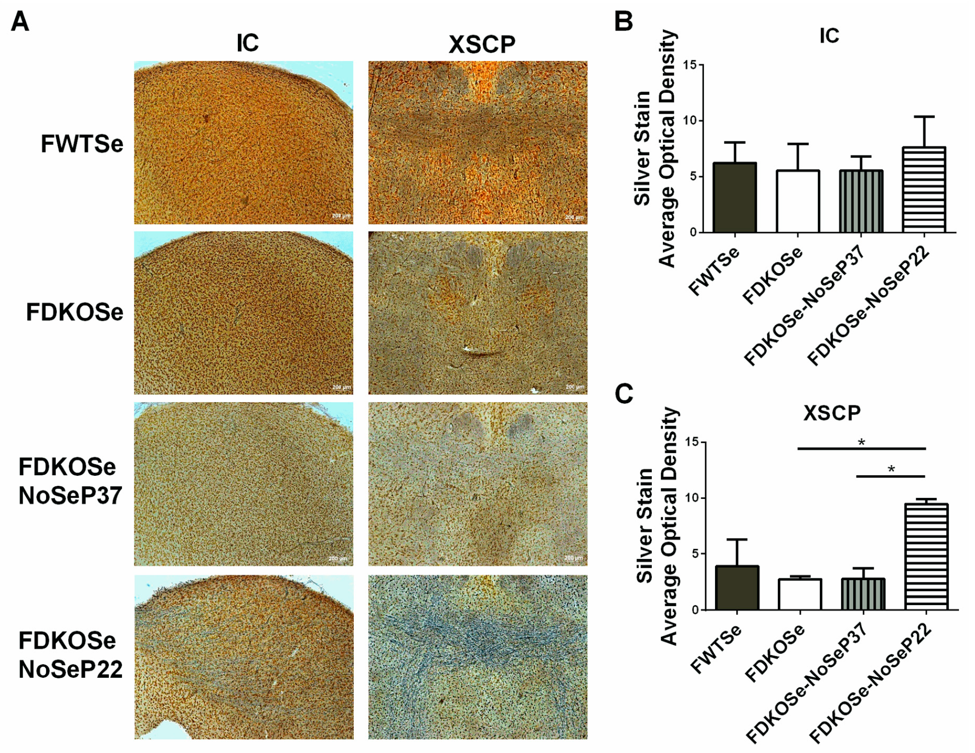 Antioxidants Free Full Text Disruption Of Selenium Handling During