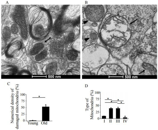 Transmission Electron Microscopy Study of Mitochondria in Aging Brain ...