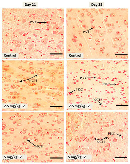 Perinatal Exposure to Tartrazine Triggers Oxidative Stress and ...