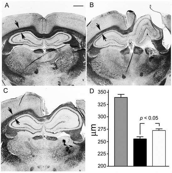 The Delayed Neuroprotective Effect of Methylene Blue in Experimental ...