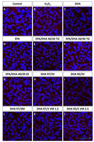 A Higher Proportion of Eicosapentaenoic Acid (EPA) When Combined with ...