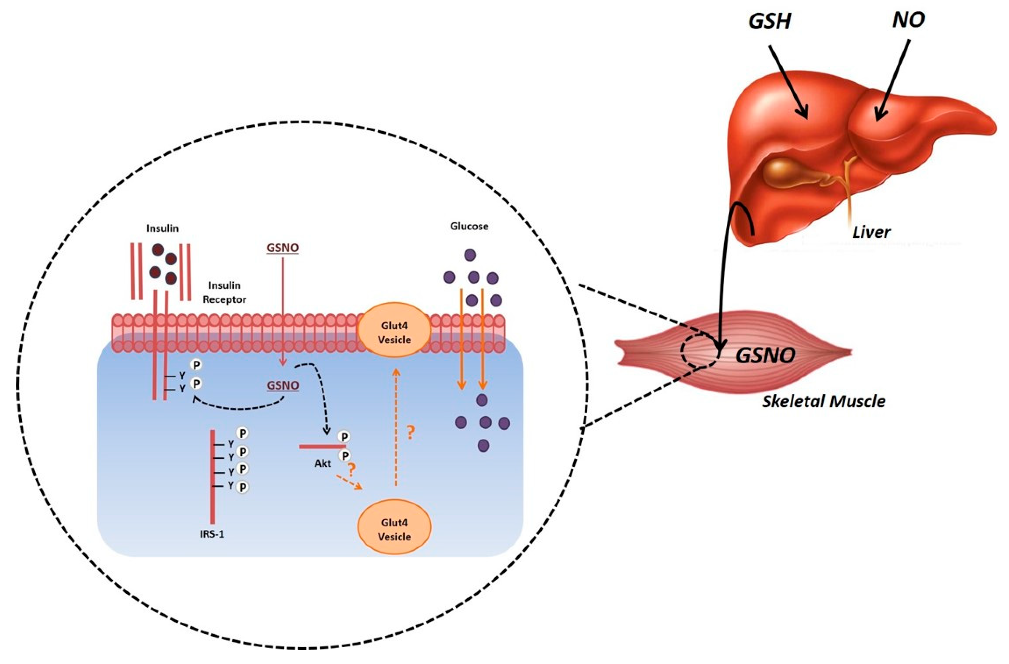 S-Nitrosoglutathione Reverts Dietary Sucrose-Induced Insulin Resistance