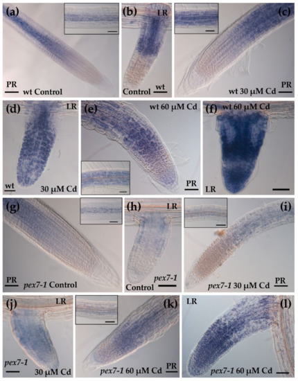 Peroxisomal PEX7 Receptor Affects Cadmium-Induced ROS and Auxin ...