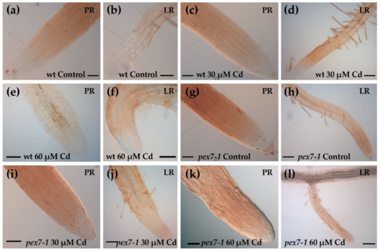 Peroxisomal PEX7 Receptor Affects Cadmium-Induced ROS and Auxin ...