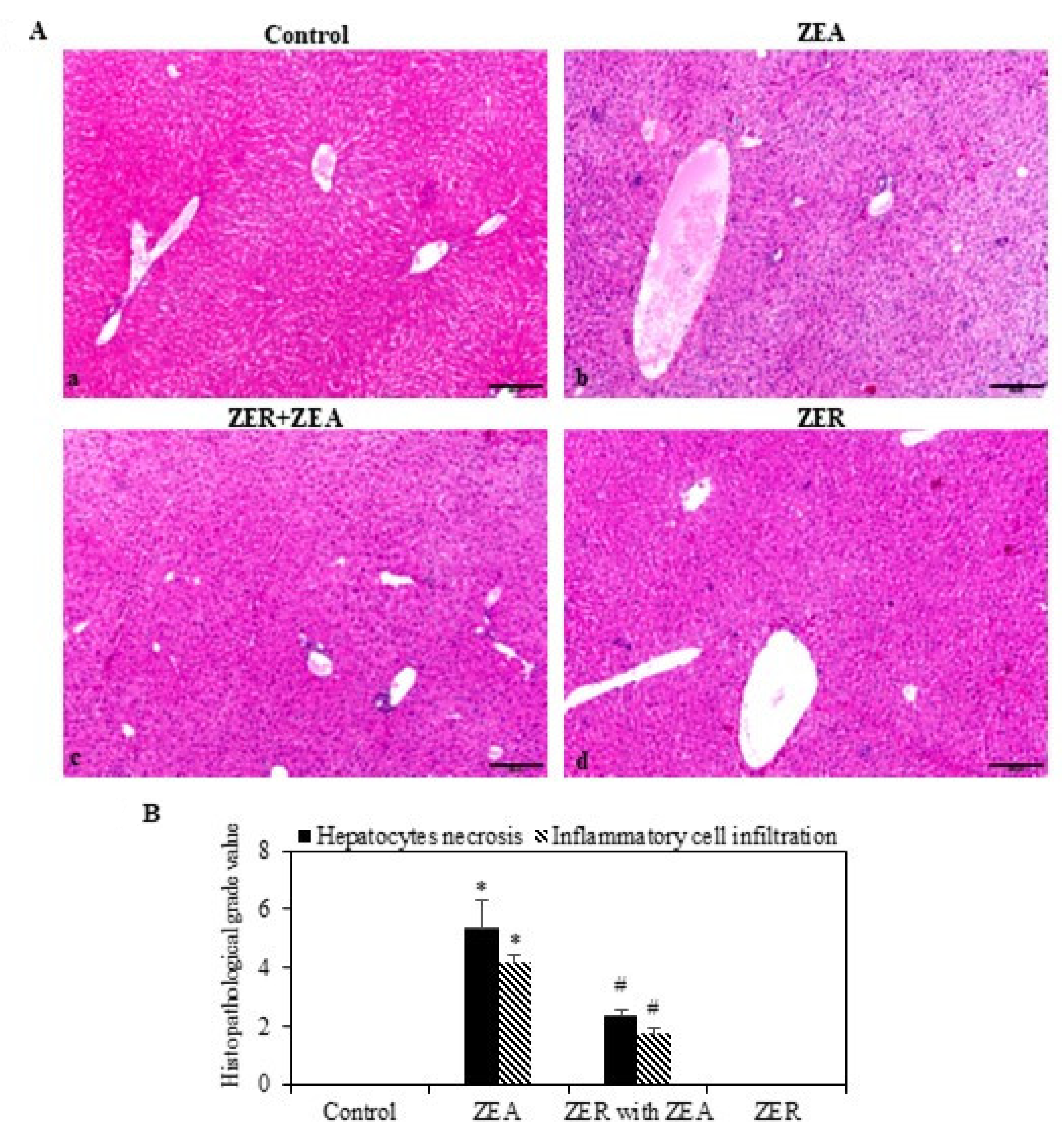 Zerumbone Exhibit Protective Effect against Zearalenone Induced ...