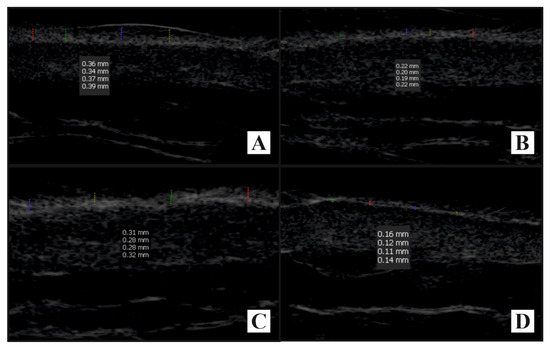 Taxifolin as a Promising Ingredient of Cosmetics for Adult Skin