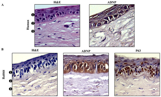 Activity-Dependent Neuroprotective Protein (ADNP)-Derived Peptide (NAP ...