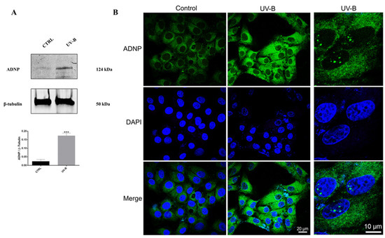 Activity-Dependent Neuroprotective Protein (ADNP)-Derived Peptide (NAP ...