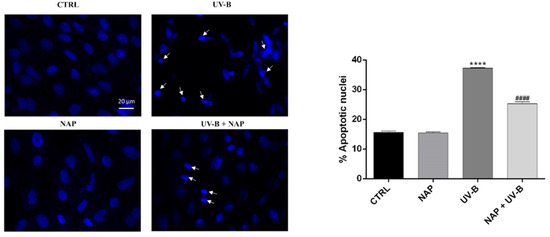Activity-Dependent Neuroprotective Protein (ADNP)-Derived Peptide (NAP ...
