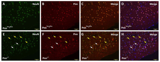 Neuronal Pnn Deficiency Increases Oxidative Stress and Exacerbates ...