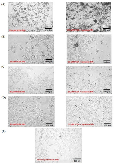 Squalene Loaded Nanoparticles Effectively Protect Hepatic AML12 Cell ...