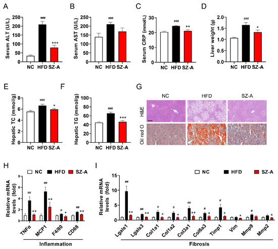 Ramulus Mori (Sangzhi) Alkaloids Alleviate High-Fat Diet-Induced ...