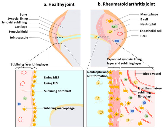 The Role of Reactive Oxygen Species in the Rheumatoid Arthritis ...