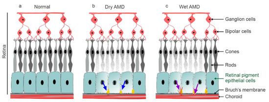 Epoxomicin, a Selective Proteasome Inhibitor, Activates AIM2 ...
