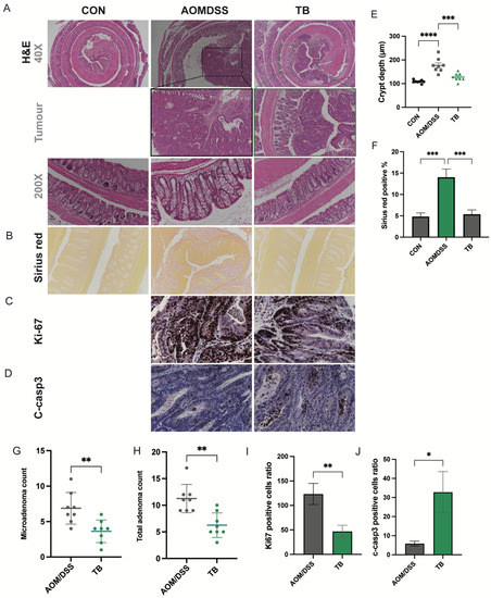 Theabrownin Alleviates Colorectal Tumorigenesis in Murine AOM/DSS Model ...