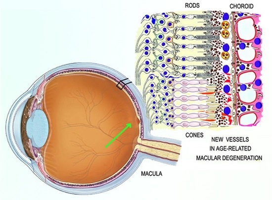 Antioxidants | Free Full-Text | Oxidative Stress Implication in Retinal ...