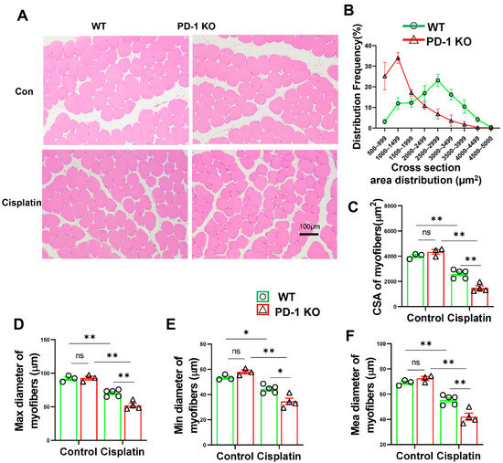 PD-1 Alleviates Cisplatin-Induced Muscle Atrophy by Regulating ...