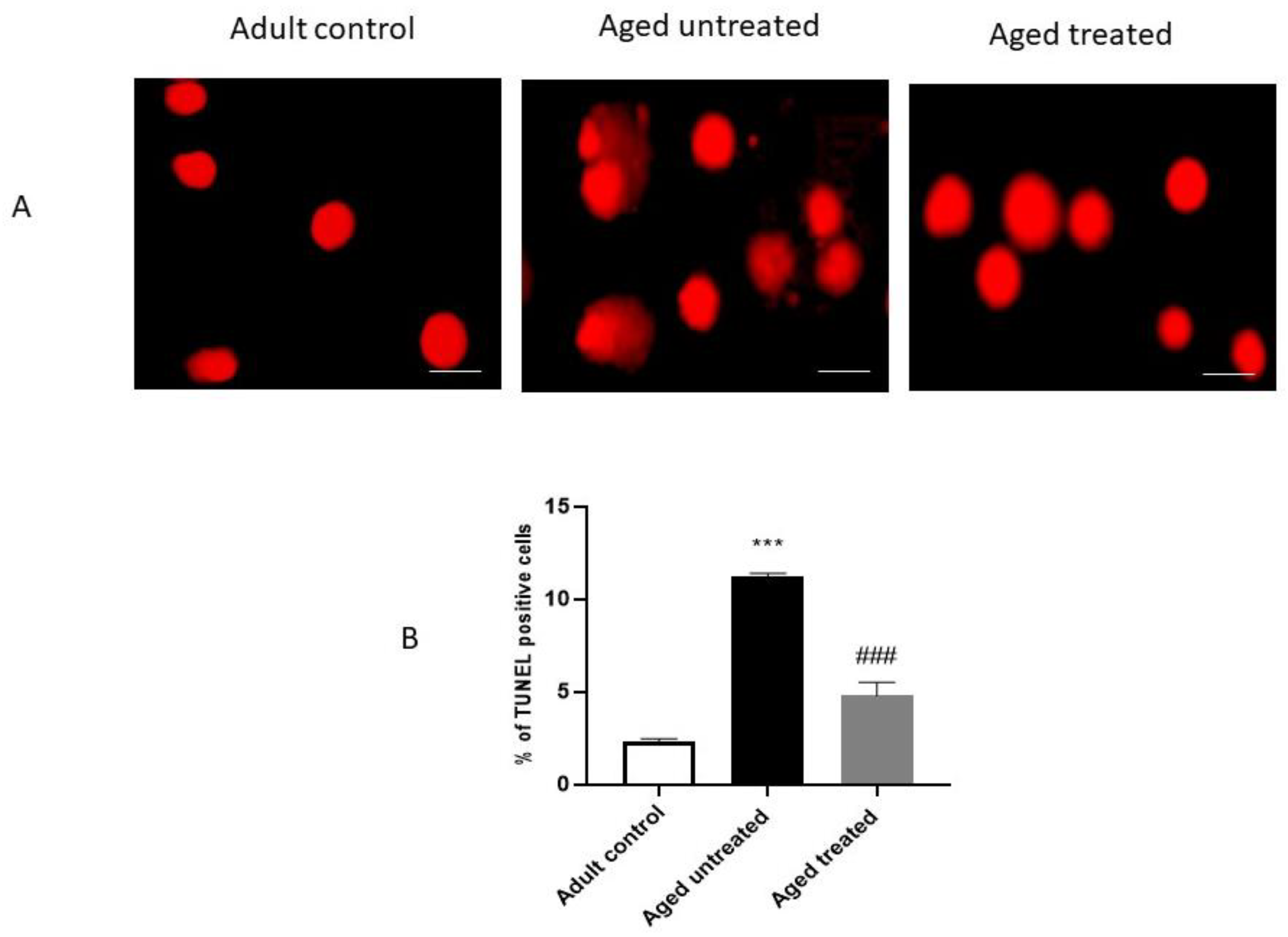 Vitamin K2 (MK-7) Intercepts Keap-1/Nrf-2/HO-1 Pathway and Hinders ...