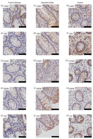 Hydrogen Sulfide Metabolizing Enzymes in the Intestinal Mucosa in ...