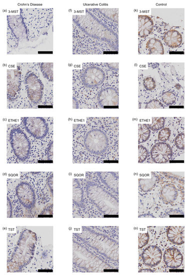Hydrogen Sulfide Metabolizing Enzymes in the Intestinal Mucosa in ...