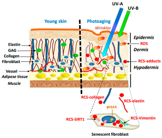 Post-Translational Modifications Evoked by Reactive Carbonyl Species in ...