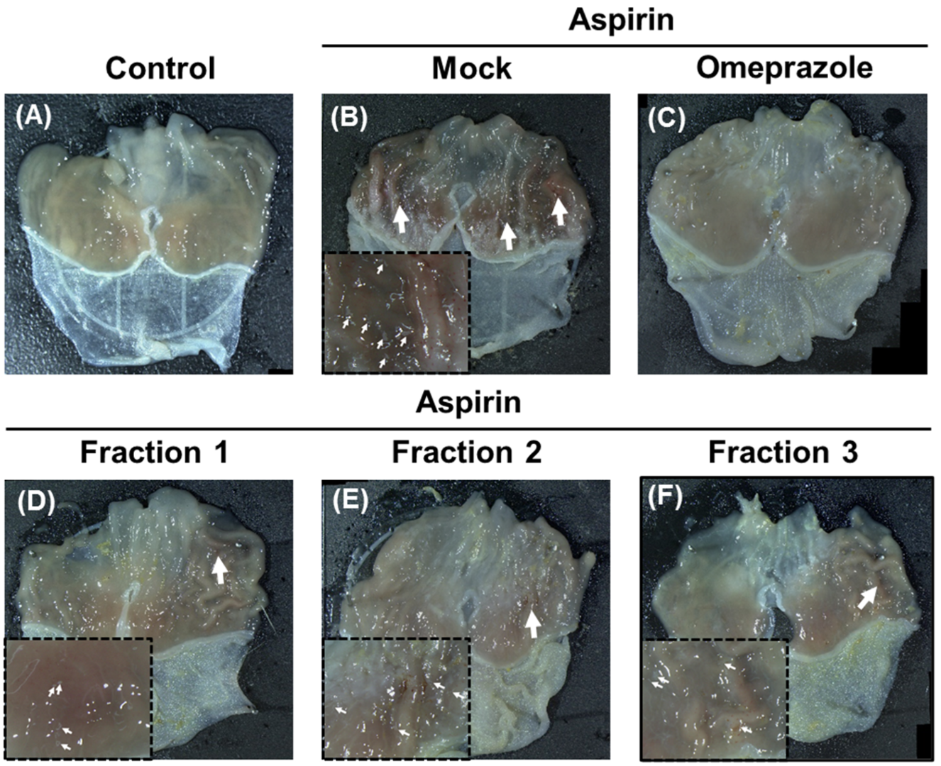 Antioxidants Free Full Text Gastroprotective Effect Of Anisomeles Indica On Aspirin Induced
