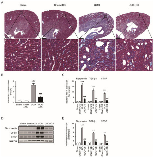 Protective Effects of Carnosol on Renal Interstitial Fibrosis in a ...