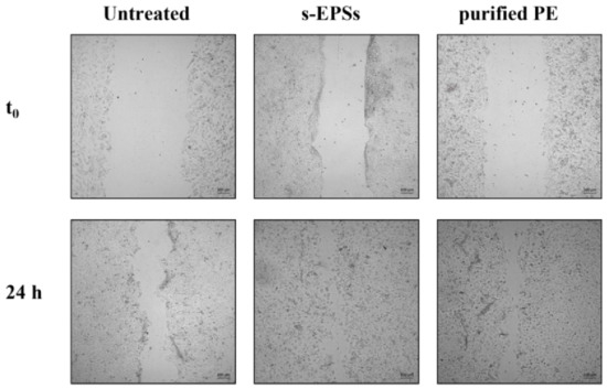 Shedding Light on the Hidden Benefit of Porphyridium cruentum Culture