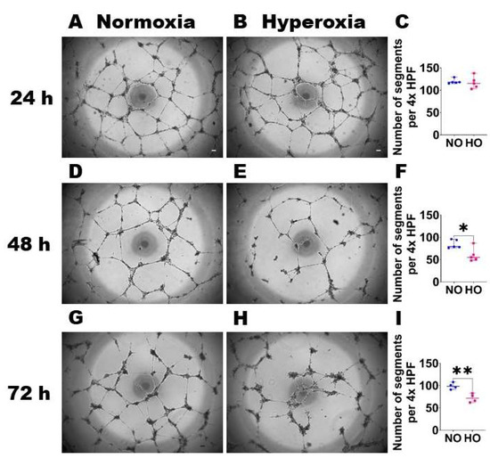 Hyperoxia Disrupts Lung Lymphatic Homeostasis in Neonatal Mice
