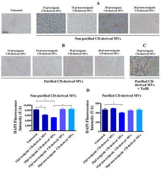 Antioxidants | Free Full-Text | Membrane Vesicles of Toxigenic ...