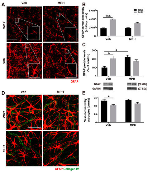 Attention-Deficit/Hyperactivity Disorder Animal Model Presents Retinal ...