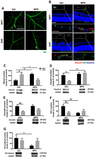 Attention-Deficit/Hyperactivity Disorder Animal Model Presents Retinal ...