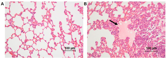 A Rodent Model of Human-Dose-Equivalent 5-Fluorouracil: Toxicity in the ...