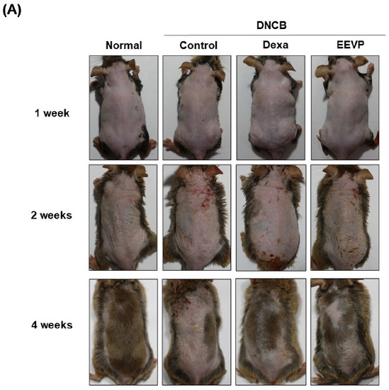 Veronica persica Ethanol Extract Ameliorates Dinitrochlorobenzene ...
